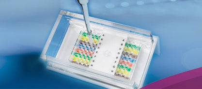 Chromsystems - Kit for Combined Analysis of Vitamin B1 and B6 – Astral ...